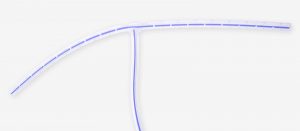 VariVac - Ascend Surgical & Medical